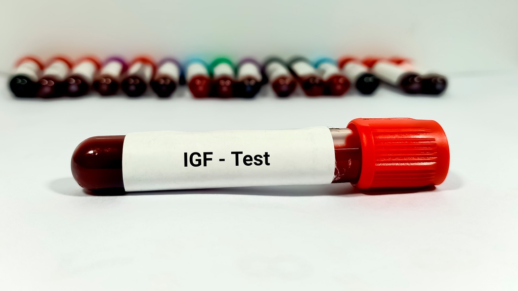 Somatomedina - C (IGF-1) | Lapi Laboratorio Médico