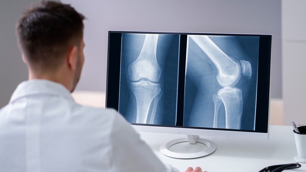 RX Rodillas Tang. 3 Proy. (30-60-90) Axiales | Lapi Laboratorio Médico