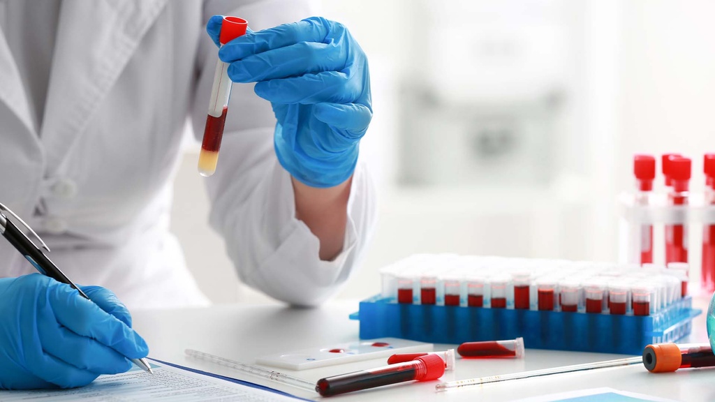 Perfil 24 | Lapi Laboratorio Médico