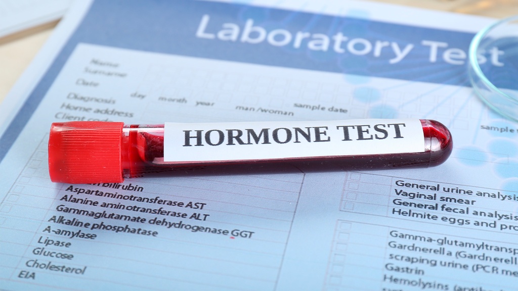 Perfil Hormonal | Lapi Laboratorio Médico