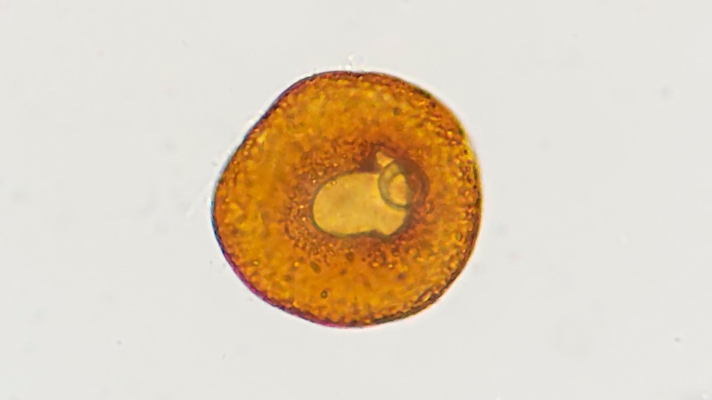 Amiba en fresco | Lapi Laboratorio Médico