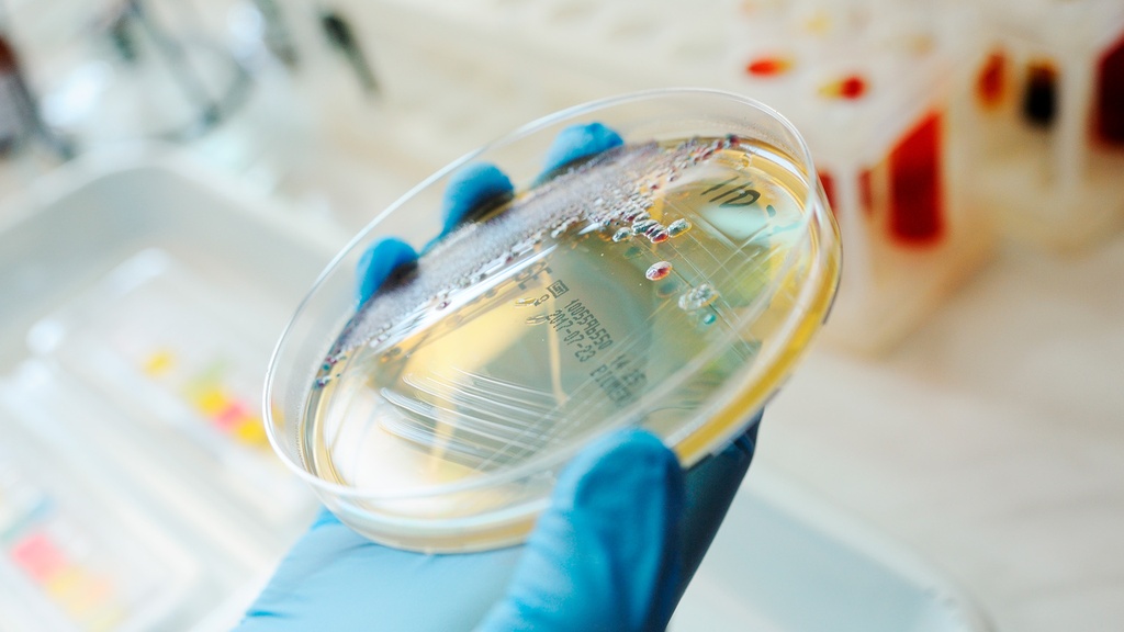 Coprológico | Lapi Laboratorio Médico