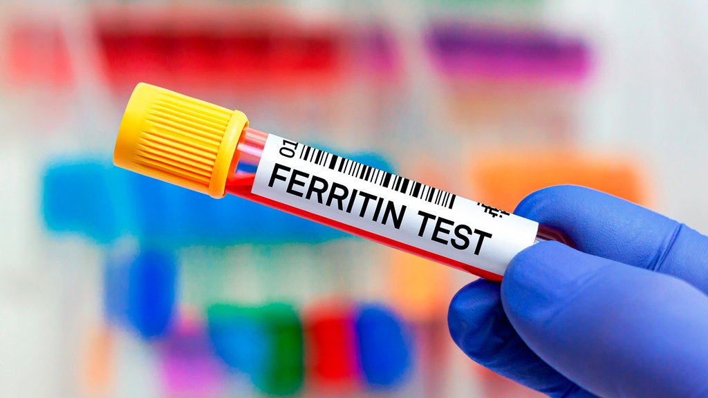 Ferritina | Lapi Laboratorio Médico