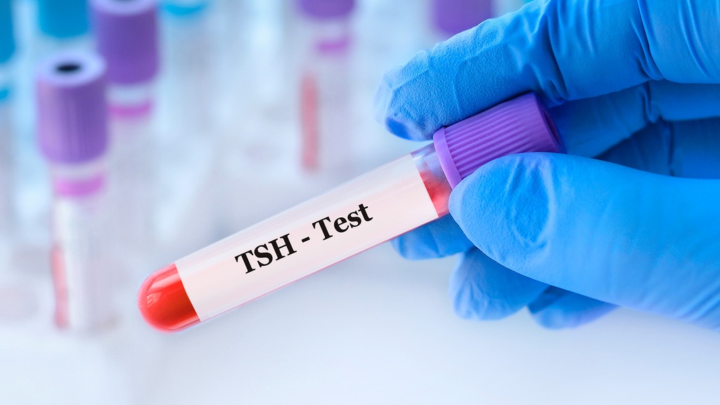 TSH (H. Estimulante de Tiroides) | Lapi Laboratorio Médico