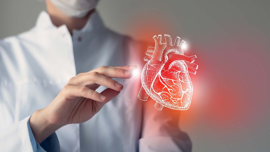 Perfil Cardiaco II | Lapi Laboratorio Médico