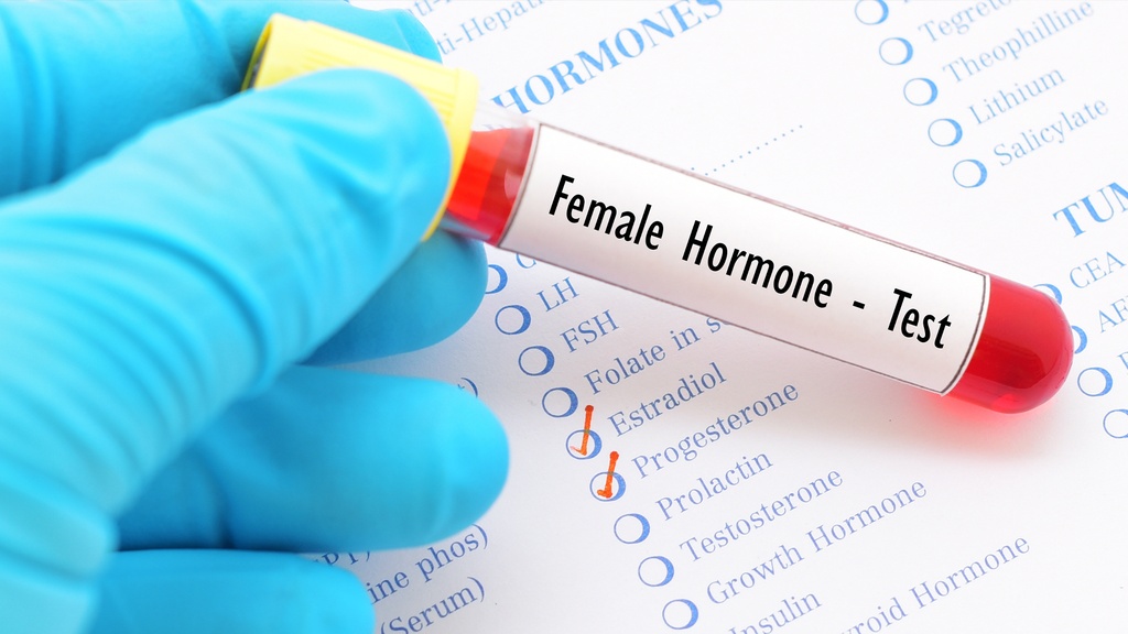 Perfil Hormonal Femenino | Lapi Laboratorio Médico