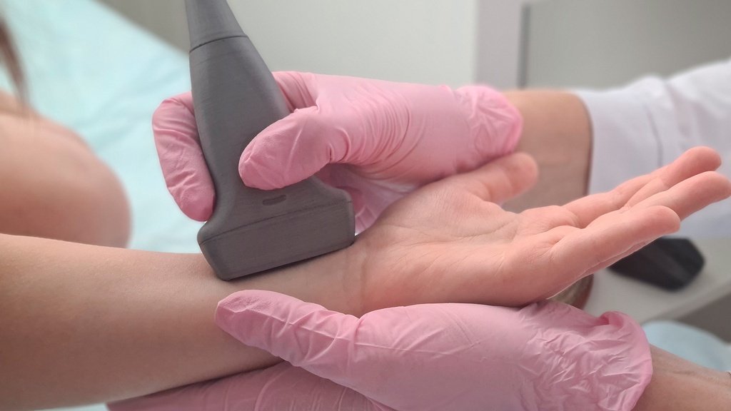 Doppler Venoso De Miembro Superior Izquerdo | Lapi Laboratorio Médico