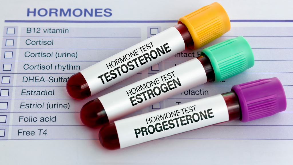Perfil Hormonal Masculino Completo | Lapi Laboratorio Médico